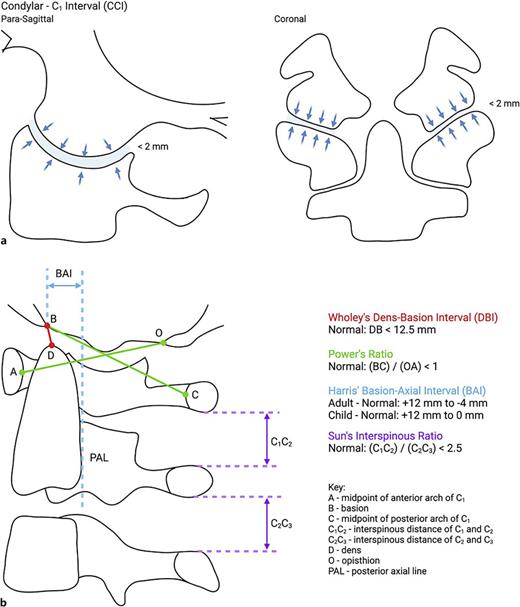 Pediatric Cervical Spine Trauma: Injury Patterns, Diagnosis, and ...
