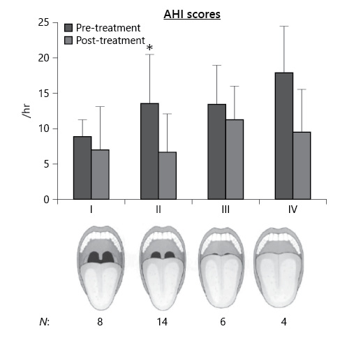 The Effectiveness of Nasal Airway Stent Therapy for the Treatment of ...