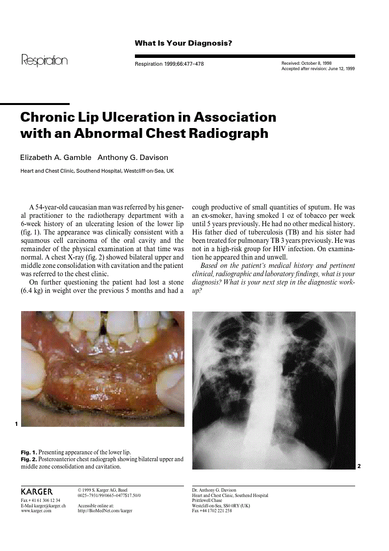 Chronic Lip Ulceration in Association with an Abnormal Chest Radiograph ...
