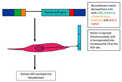 Alpha One Antitrypsin Deficiency: From Gene to Treatment | Respiration ...