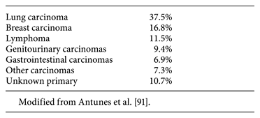 Diagnostic Work-Up of Pleural Effusions | Respiration | Karger Publishers