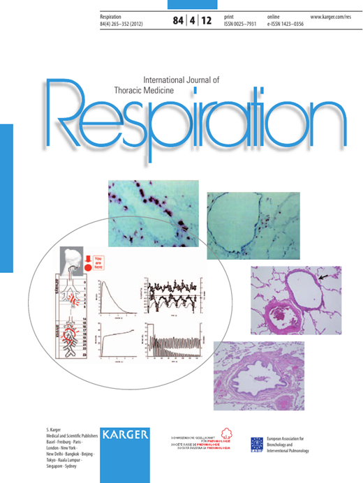 Tension Pyopneumothorax due to a Ruptured Pulmonary Echinococcal Cyst ...