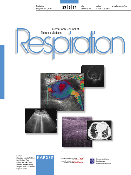 Pneumothorax following Endobronchial Valve Therapy and Its Impact on ...