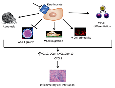 Acneiform Rash Induced by EGFR Inhibitors: Review of the Literature and ...