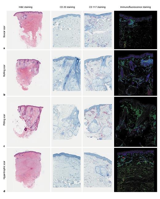 Myofibroblasts, B Cells, and Mast Cells in Different Types of Long ...