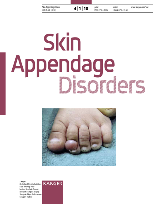 Acneiform Rash Caused by an Unlikely Drug: Topiramate | Skin Appendage ...