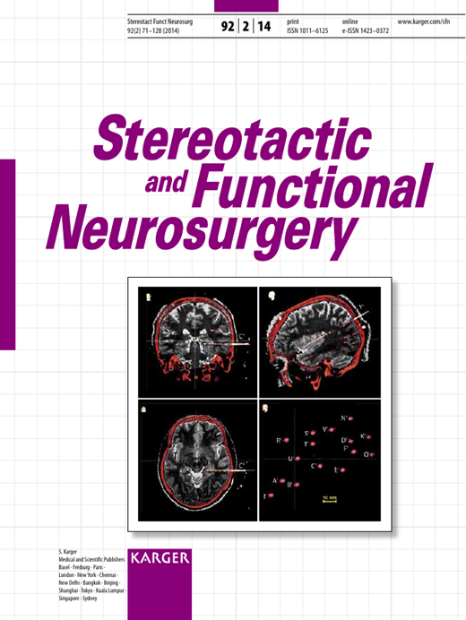 A Personalized Stereotactic Fixture for Implantation of Depth ...