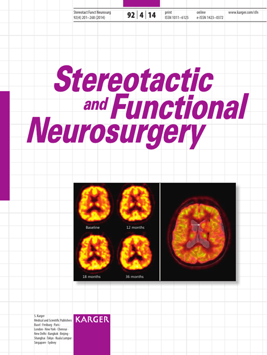 Multiple Sclerosis-Related Trigeminal Neuralgia: A Prospective Series ...