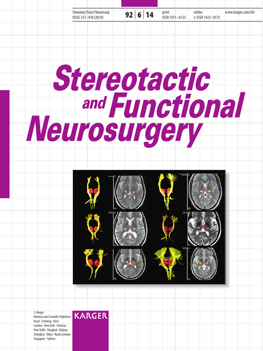 Laser Ablation as Treatment Strategy for Medically Refractory Dominant ...