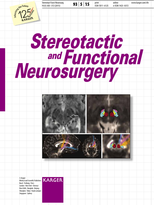 Anterior Temporal Sulcus: A Reliable Intraoperative Landmark for ...