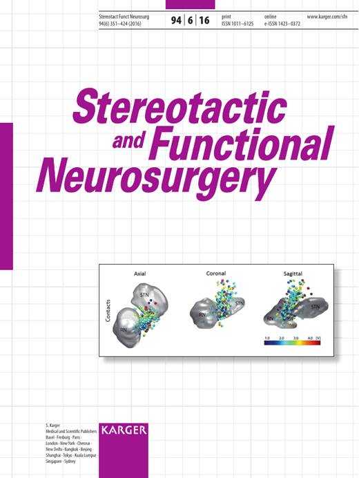 Deep Brain Stimulation of the Caudal Zona Incerta: Tremor Control in ...