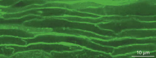 Corneocytes: Relationship between Structural and Biomechanical ...