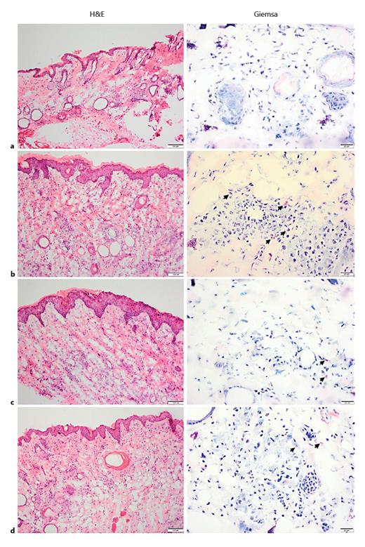 Induction of Radiodermatitis in Nude Mouse Model Using Gamma Irradiator ...