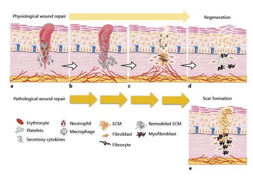 The Emerging Therapeutic Targets for Scar Management: Genetic and ...