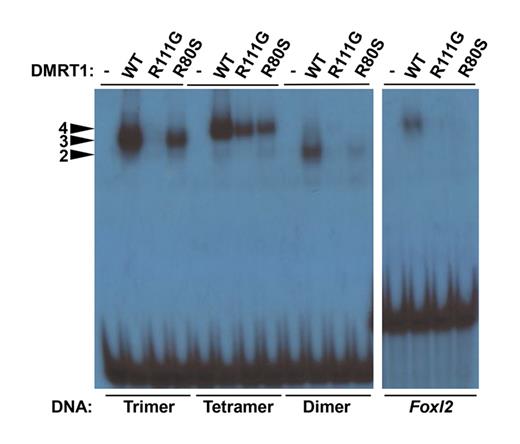 DMRT1: An Ancient Sexual Regulator Required for Human Gonadogenesis ...
