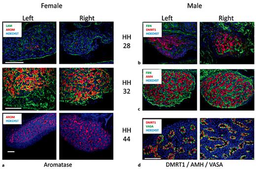 Gonadal Asymmetry and Sex Determination in Birds | Sexual Development ...