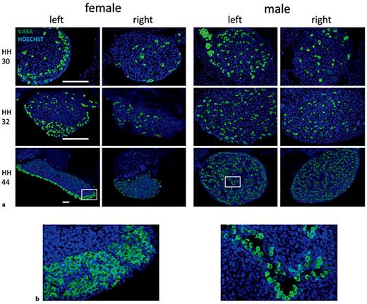 Gonadal Asymmetry and Sex Determination in Birds | Sexual Development ...