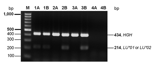 Identification of Lutheran Blood Groups and Genetic Variants within ...