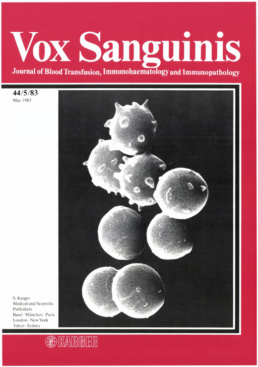 A Caucasian Family with the i Phenotype and Congenital Cataracts | Vox ...